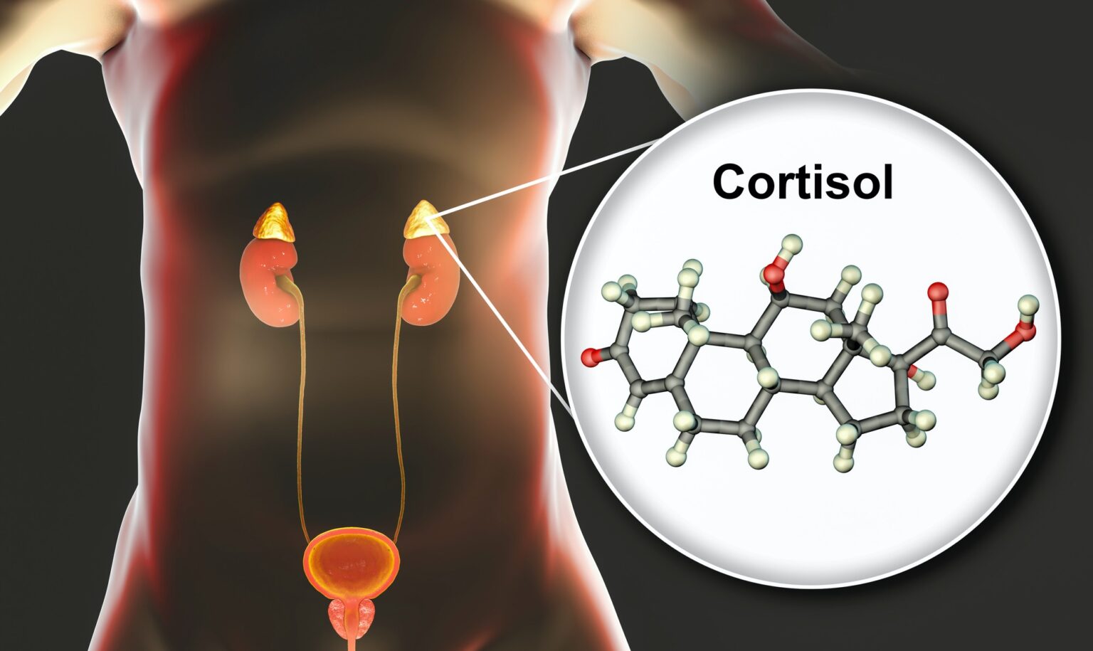 Patología muscular en pacientes con síndrome de Cushing - Con I de ...